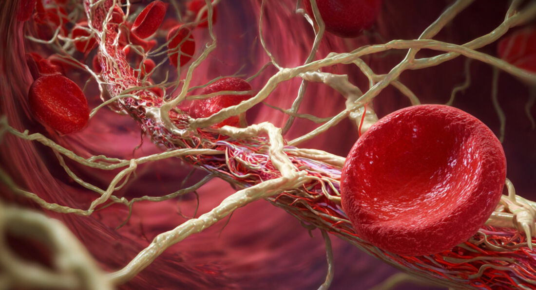 5 Natural Methods to Cleanse Arteries and Lower Plaque – LA Muscle - AU ...